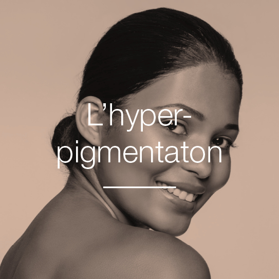 Hyperpigmentation : Taches cutanées, cicatrices d'acné. Que faire?